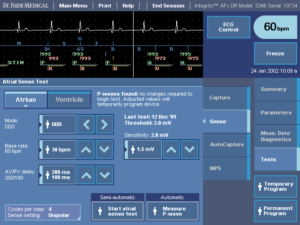 St. Jude Medical – ICD programming terminal – secondsecond